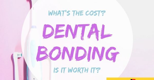 Cost of Dental Bonding - Sachem Dental Group