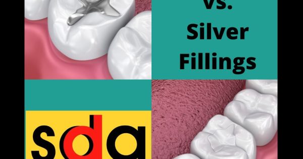 Fillings: Tooth-Colored vs. Silver Amalgam - Sachem Dental Group