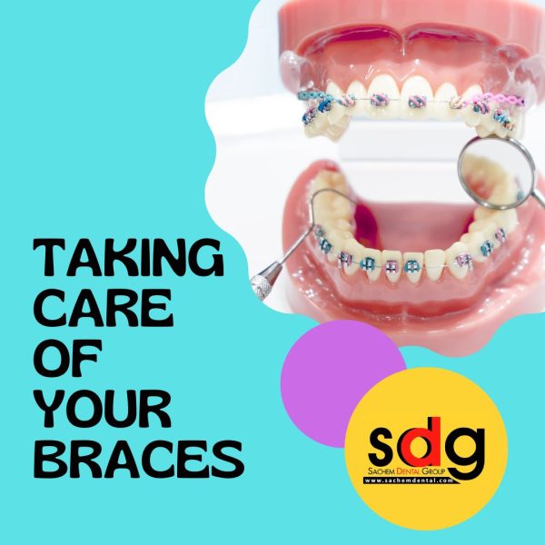 Top Tips for Taking Care of Braces