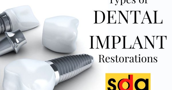 Dental Implant Restorations - Types of Tooth Replacement - Sachem ...
