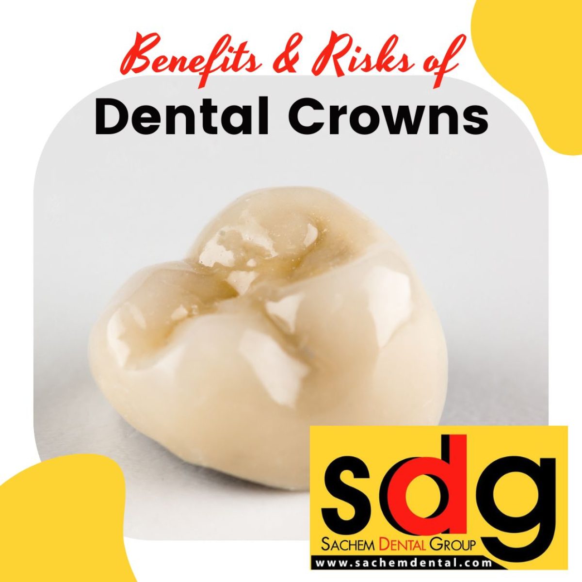 Benefits and Risks of Dental Crowns - Sachem Dental Group