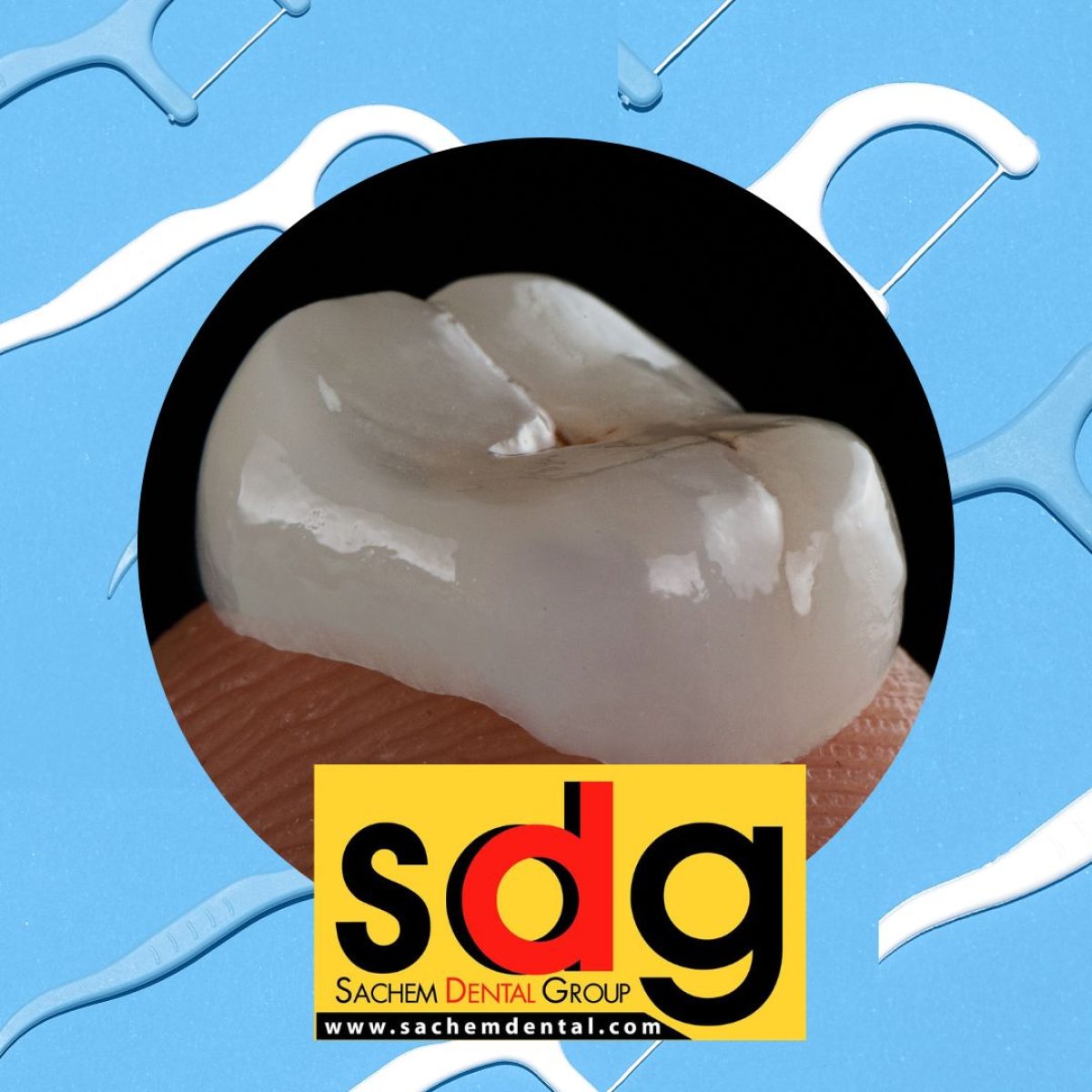 Flossing Dental Crown? - Sachem Dental Group