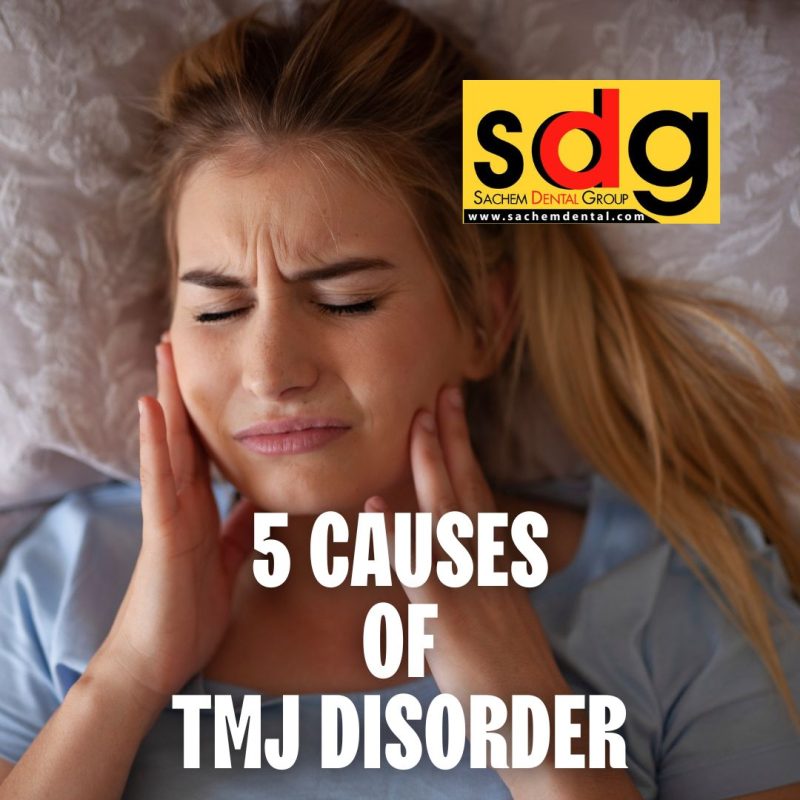 Five Causes of TMJ Disorder - Sachem Dental Group